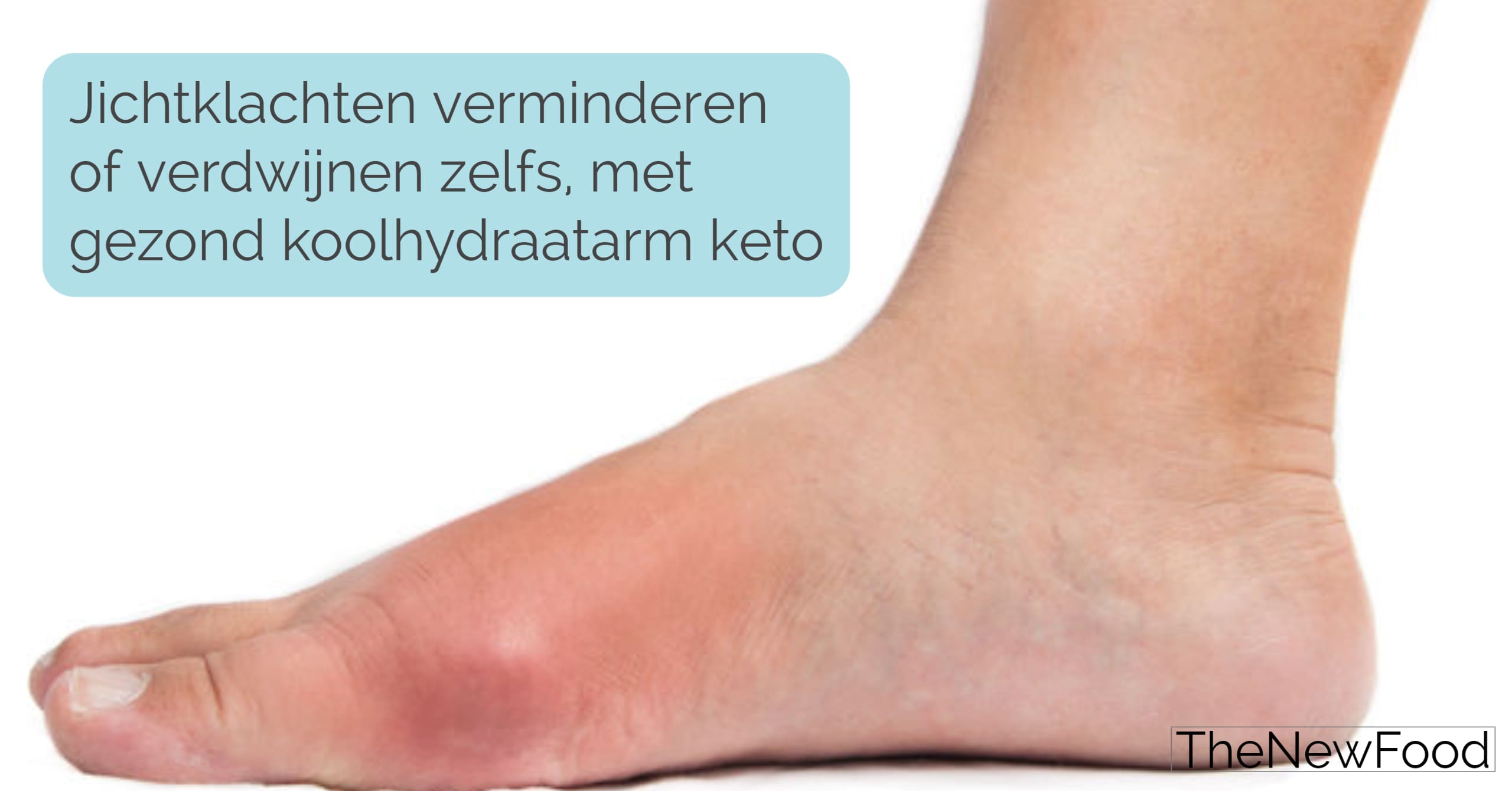 Jicht en gezond koolhydraatarme/keto - TheNewFood